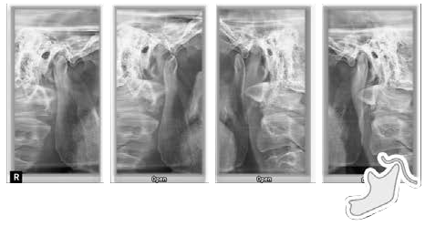 RayScan Alpha - ic med